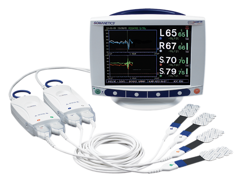 INVOS™ - Monitor da perfusão cerebral - Medicalway